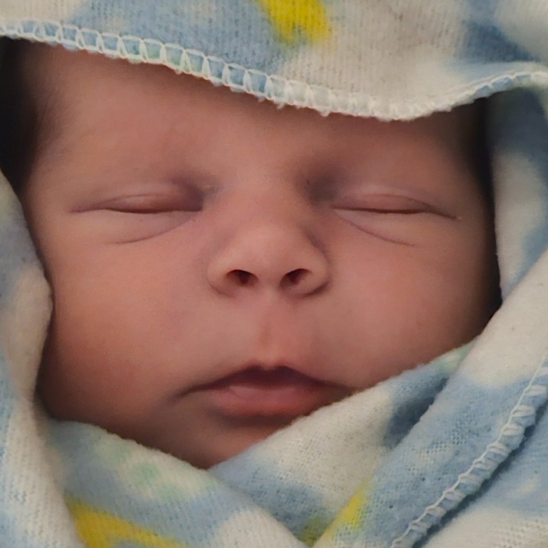 What is the verumontanum and why is it important during GreenLight ...